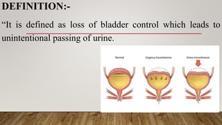 Urinary incontinence.pptx