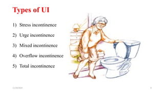 Urinary Incontinence.pptxggggggggggggggg | PPTX