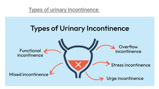 URINARY INCONTINENCE in Surgery for MBBS | PDF