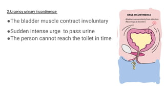 URINARY INCONTINENCE in Surgery for MBBS | PDF