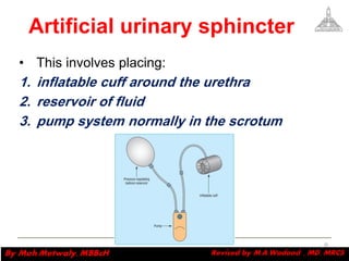 Urinary incontinence2 | PDF