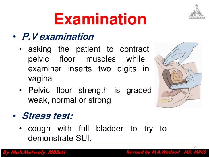 Urinary incontinence2