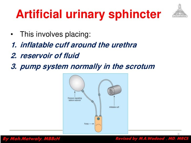 Urinary incontinence2