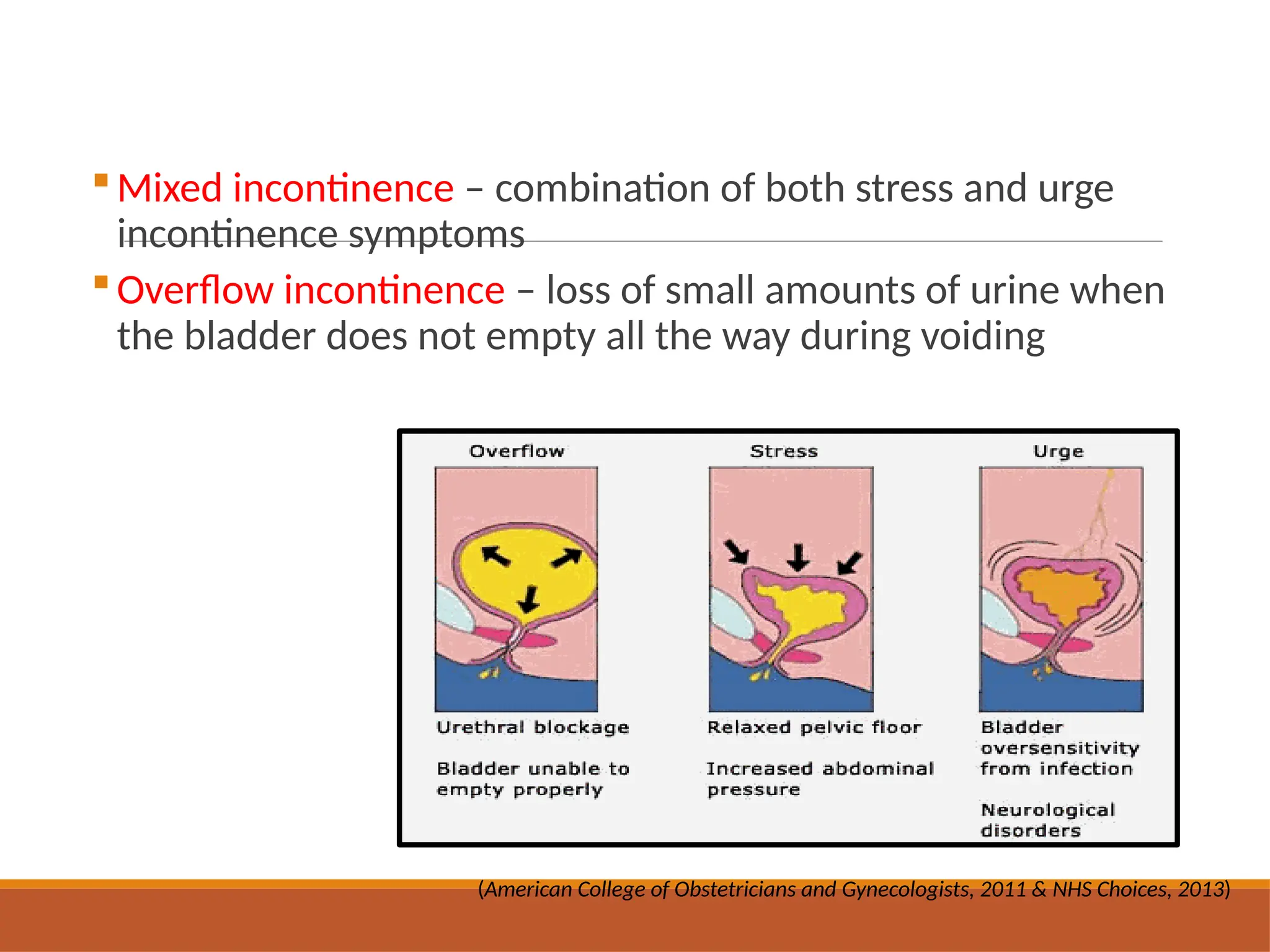 Urinary incontinence and its Treatment.pptx