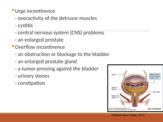 Urinary incontinence and its Treatment.pptx
