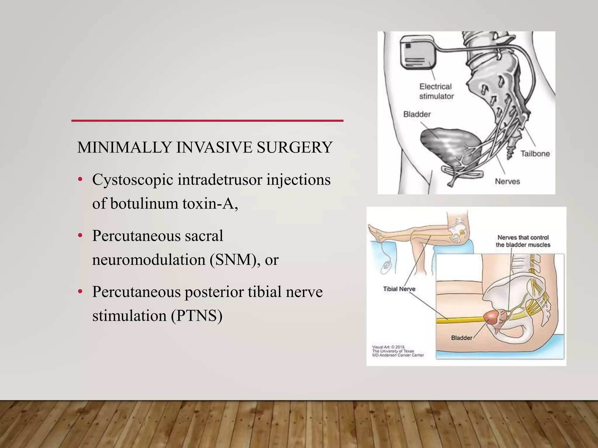 Urinary incontinence in elderly | PPTX
