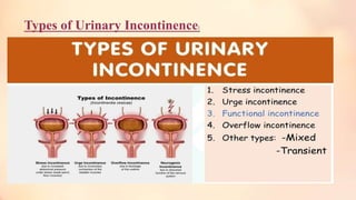 urinary incontinence in elderly.pptx