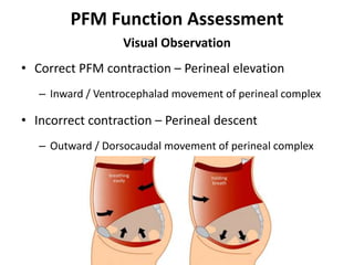 Urinary incontinence in females - Classification and non operative ...