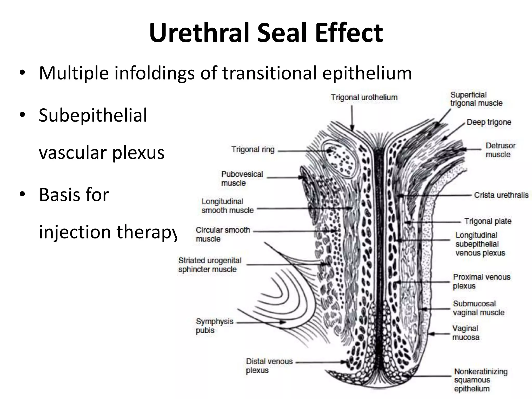 Urinary incontinence in females operative | PPTX