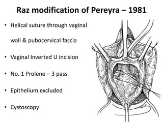 Urinary incontinence in females operative | PPTX