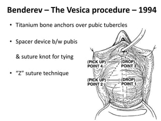 Urinary incontinence in females operative | PPTX