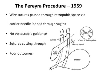 Urinary incontinence in females operative | PPT