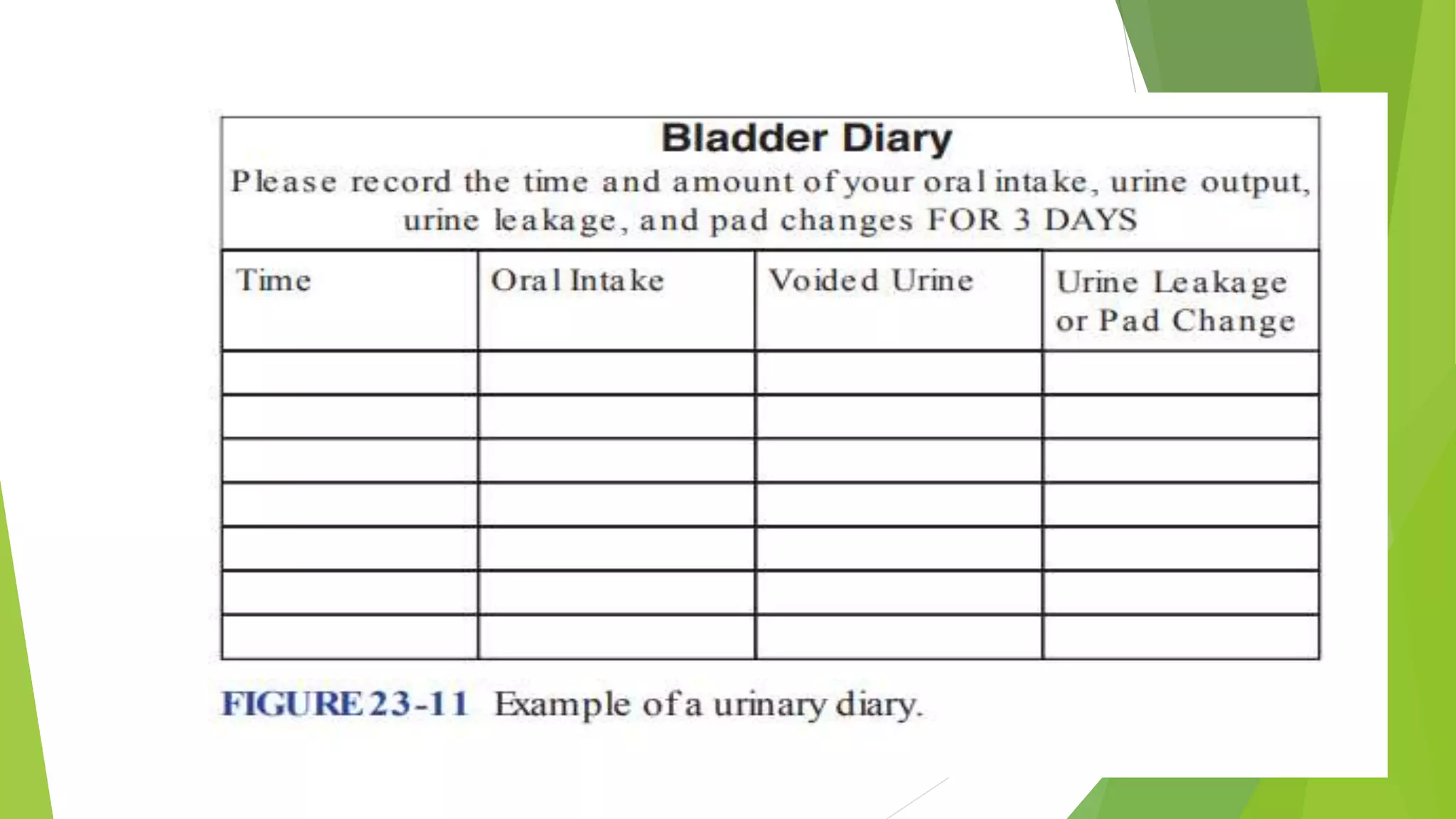 Urinary incontinence in woman | PPTX