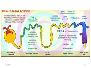 urinary lithiasis etiology , pathogenesis, types of urinary lithiasis .pptx
