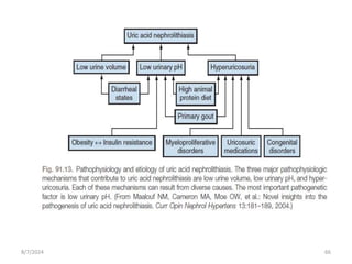 urinary lithiasis etiology , pathogenesis, types of urinary lithiasis .pptx