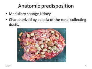 urinary lithiasis etiology , pathogenesis, types of urinary lithiasis .pptx
