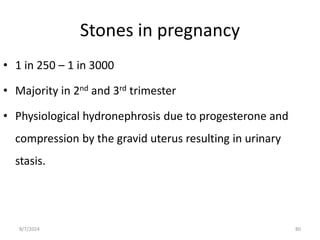 urinary lithiasis etiology , pathogenesis, types of urinary lithiasis .pptx
