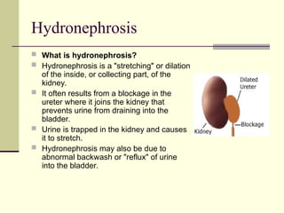 urinary obstruction and benign prostate hyperplasia.ppt