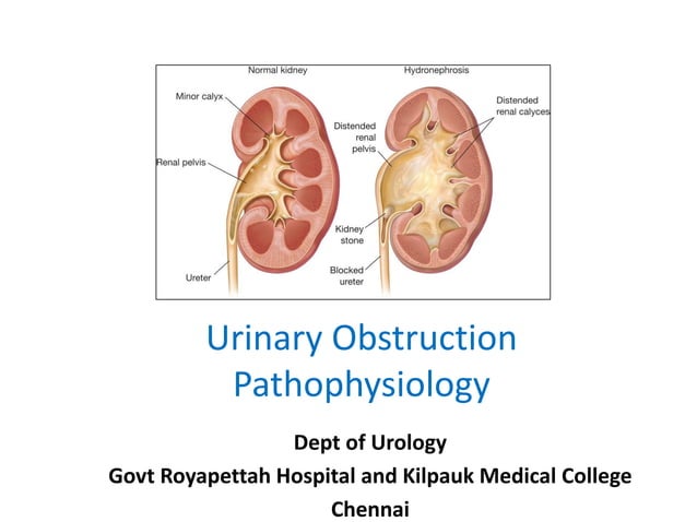 Urinary obstruction pathophysiology | PDF