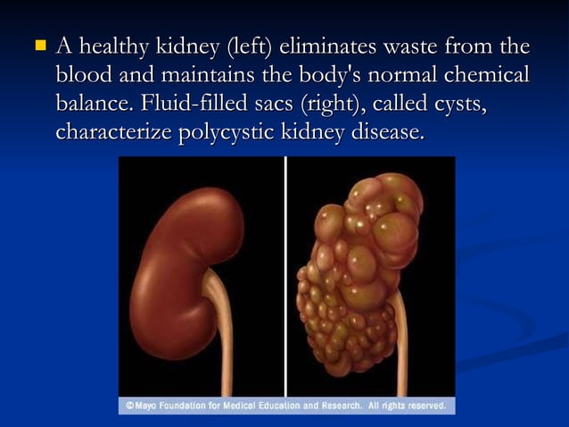 Urinary pathology | PPT