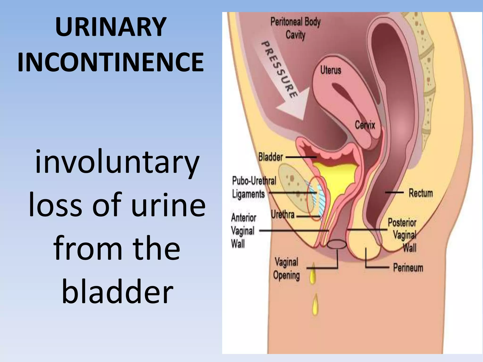 Urinary retention and incontinence | PPTX
