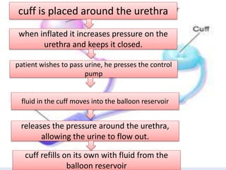 Urinary retention and incontinence | PPTX
