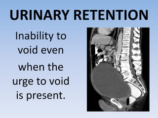 Urinary retention and incontinence | PPTX