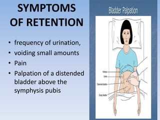 Urinary retention and incontinence | PPTX
