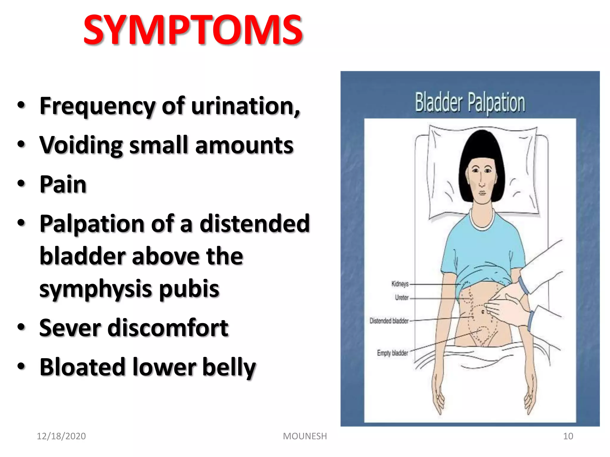 Urinary retention and incontinence | PPTX