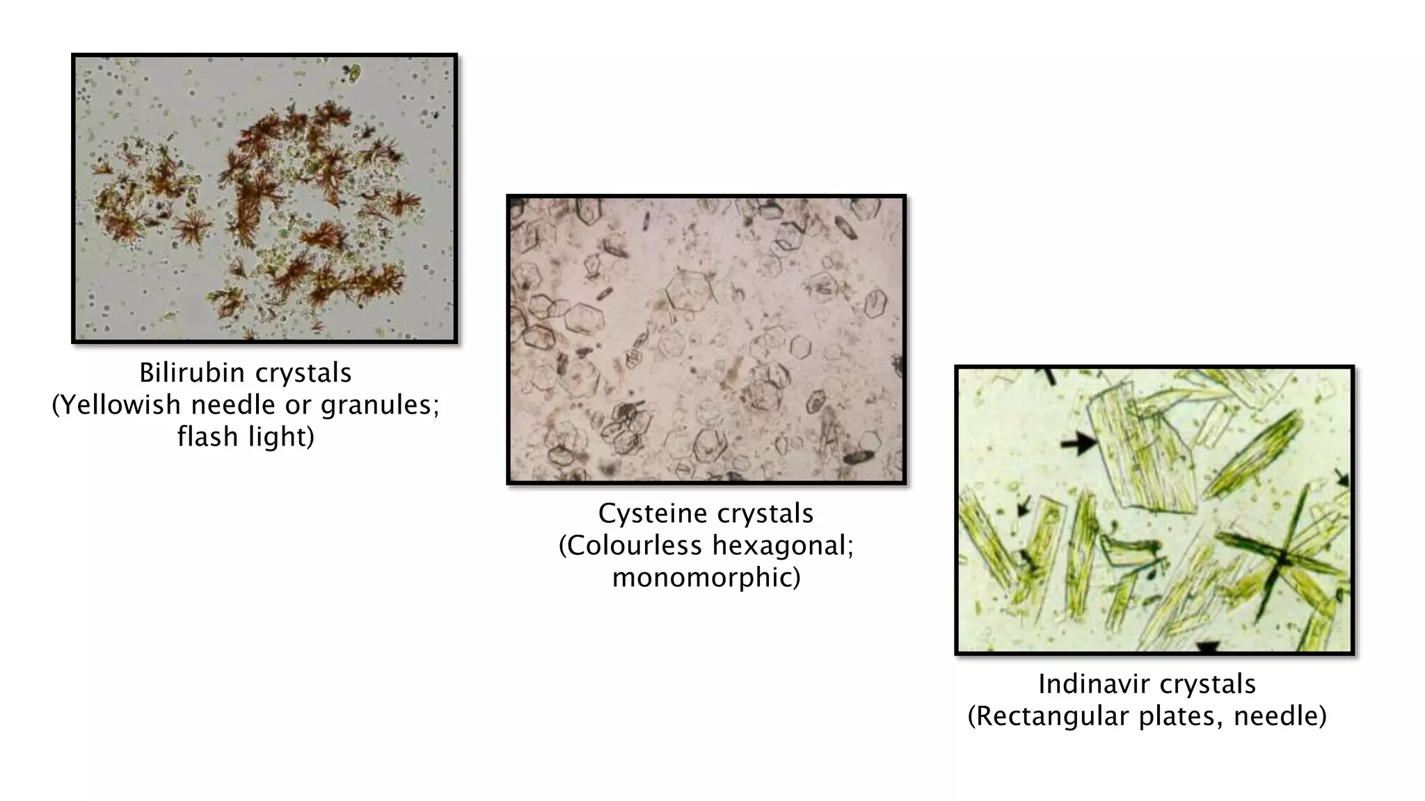 Urinary sediments under microscopic examination | PPTX