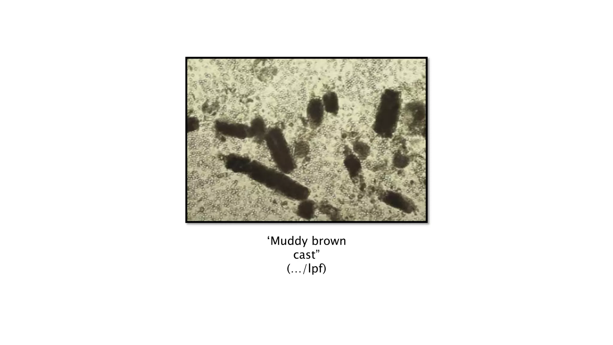 Urinary sediments under microscopic examination | PPTX