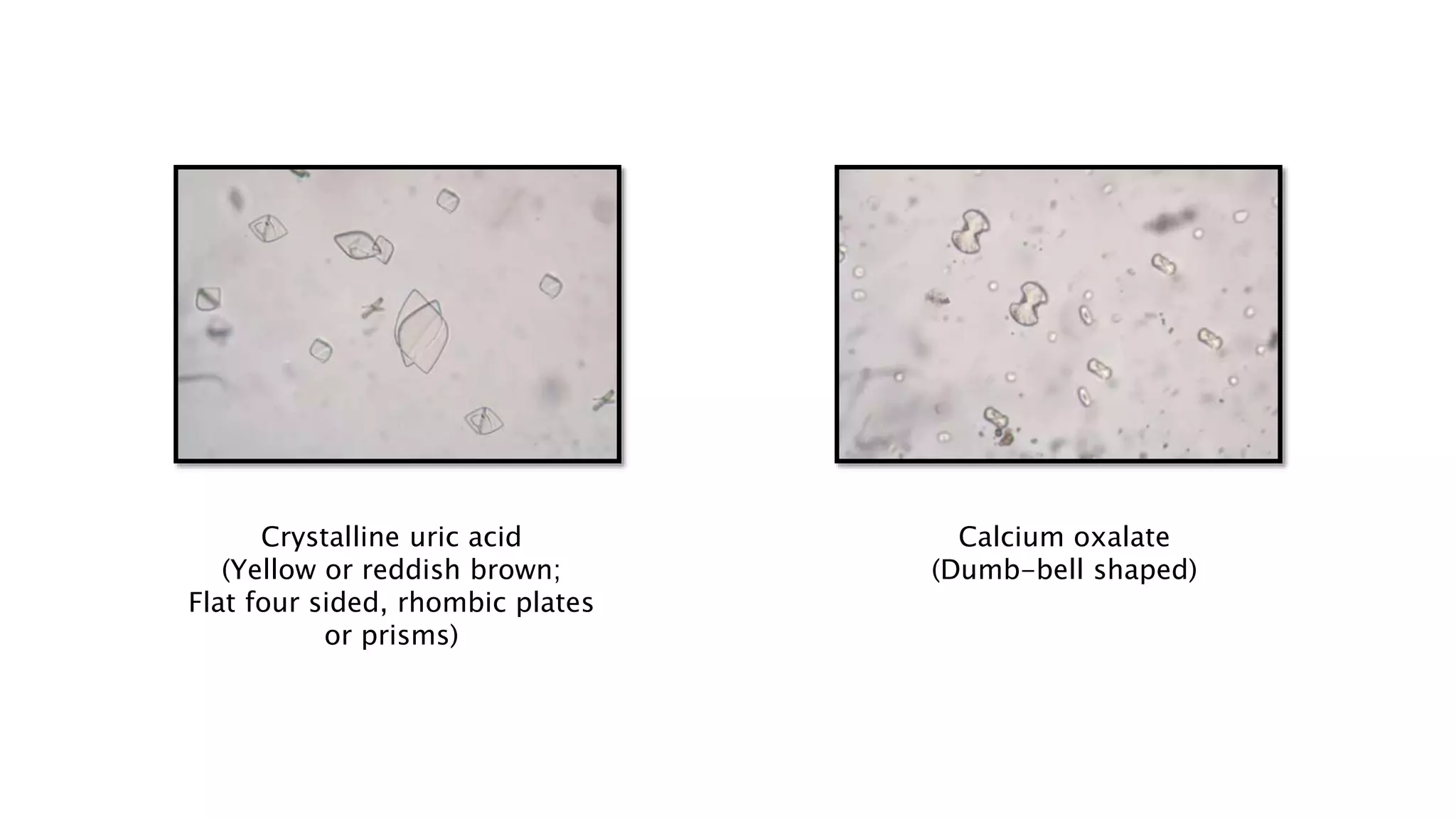 Urinary sediments under microscopic examination | PPTX