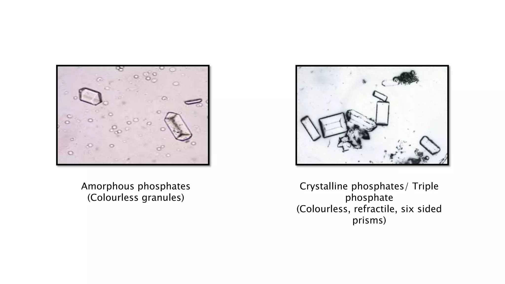 Urinary sediments under microscopic examination | PPTX