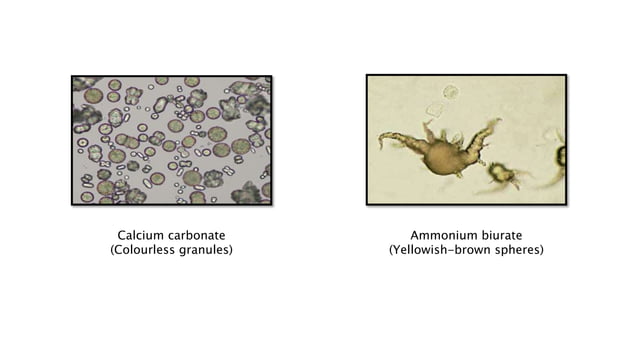 Urinary sediments under microscopic examination | PPTX | Chemistry ...