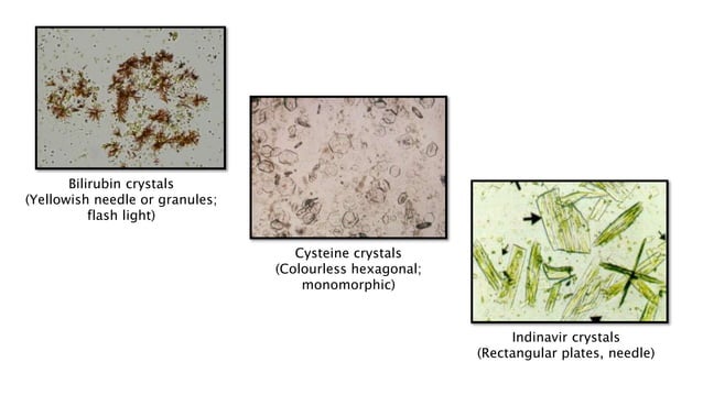 Urinary sediments under microscopic examination | PPTX | Chemistry ...