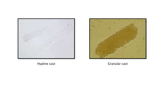 Urinary sediments under microscopic examination | PPTX