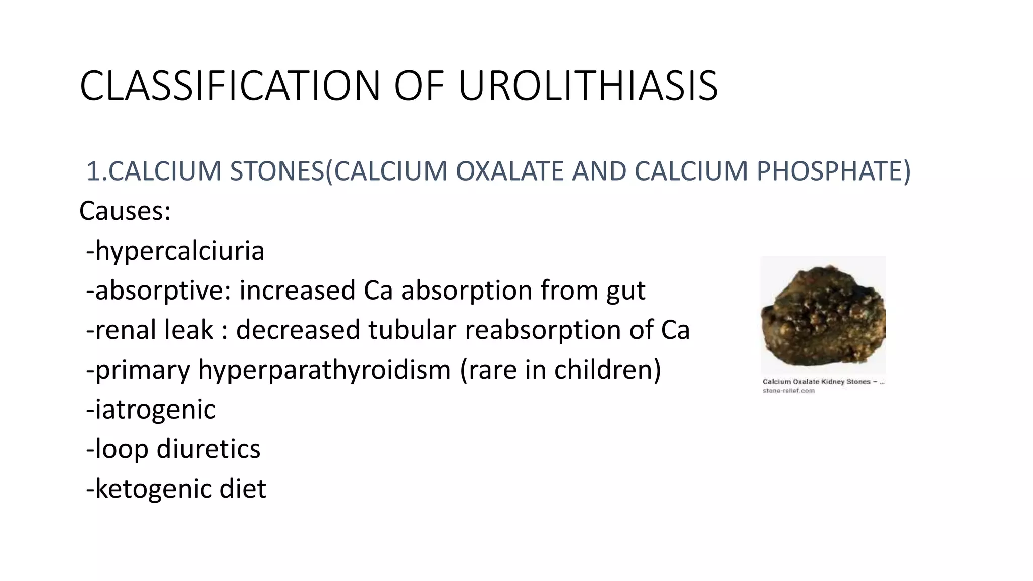 URINARY STONE DISEASE.pptx