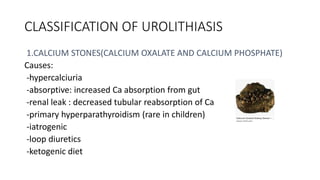 URINARY STONE DISEASE.pptx