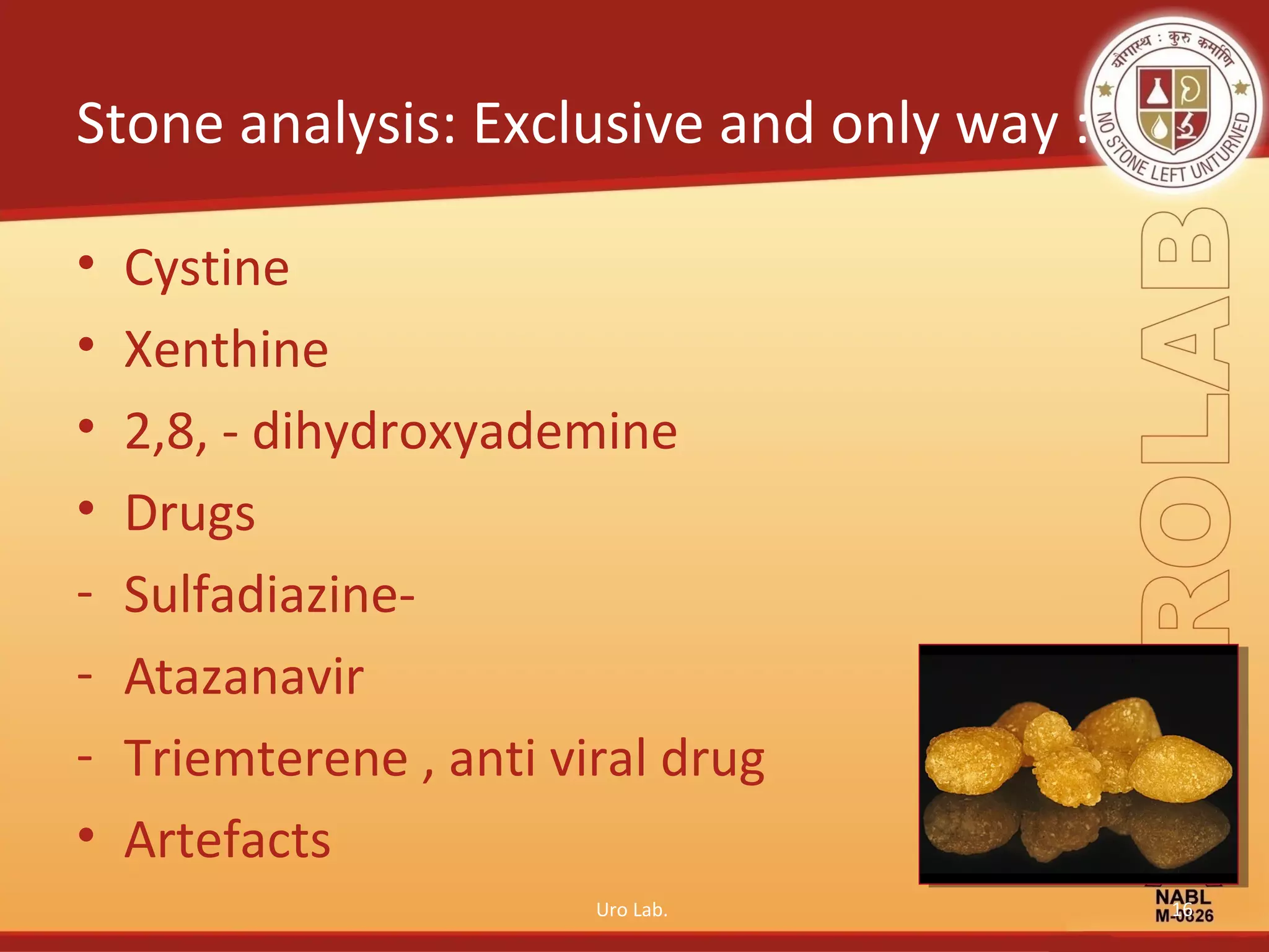 Urinary Stone disease : Metabolic work up and its significaance | PPT