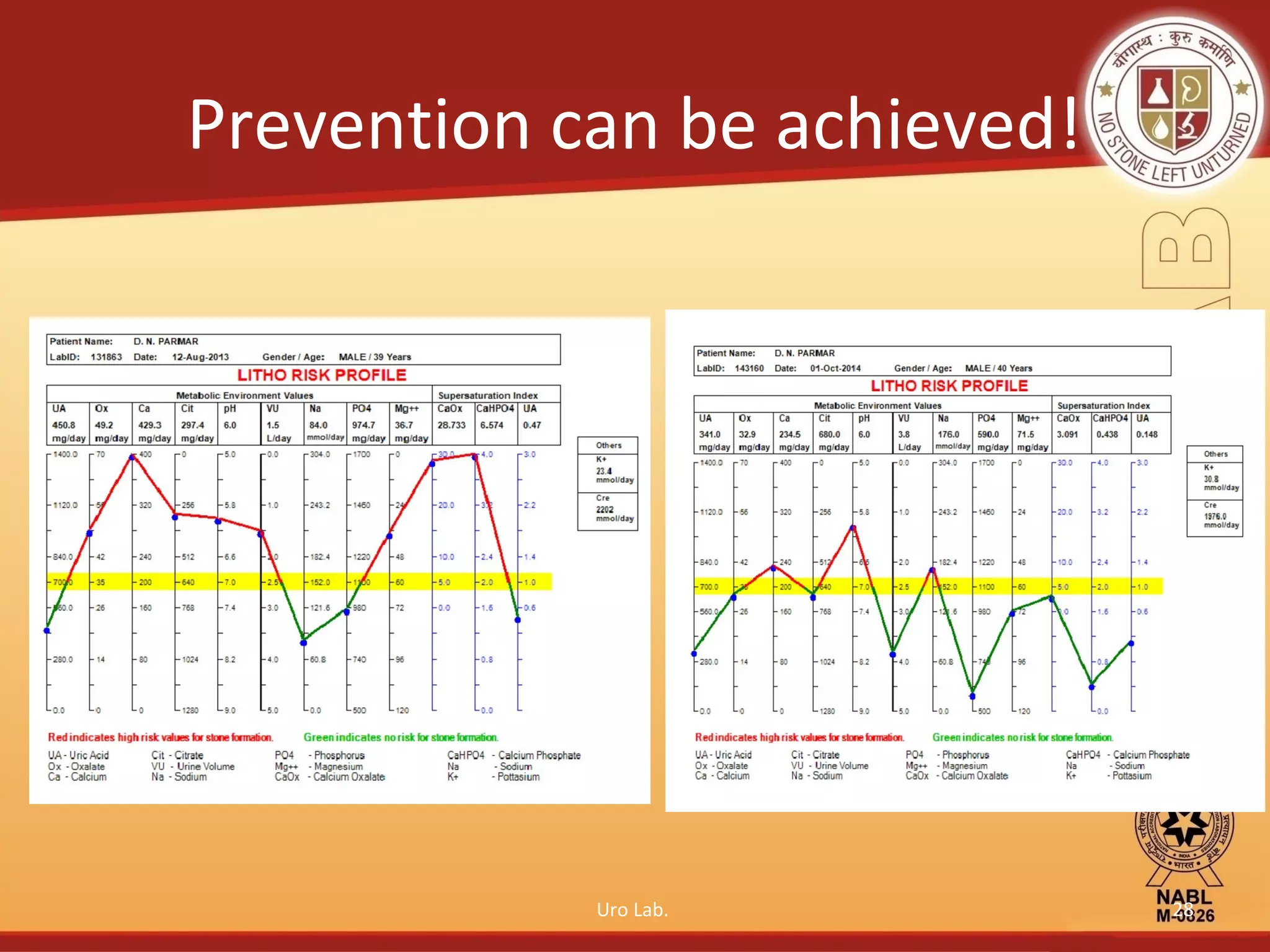 Urinary Stone disease : Metabolic work up and its significaance | PPT