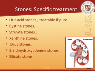 Urinary Stone disease : Metabolic work up and its significaance | PPT