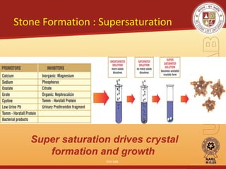 Urinary Stone disease : Metabolic work up and its significaance | PPT