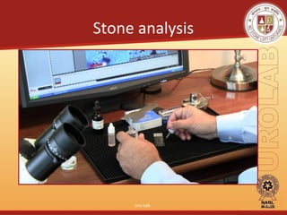 Urinary Stone disease : Metabolic work up and its significaance | PPT
