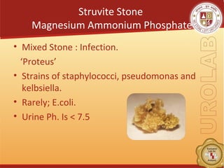 Urinary stone evaluation in laboratory and clinical significance | PPT