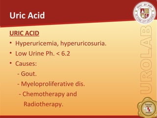 Urinary stone evaluation in laboratory and clinical significance | PPT