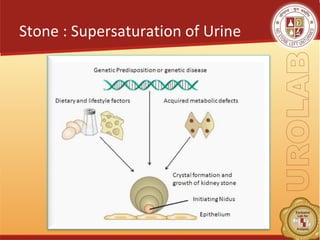 Urinary stone evaluation in laboratory and clinical significance | PPT