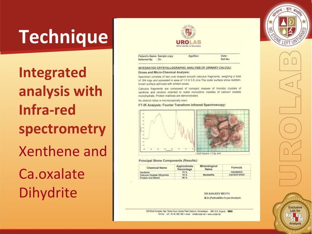 Urinary stone evaluation in laboratory and clinical significance | PPT ...