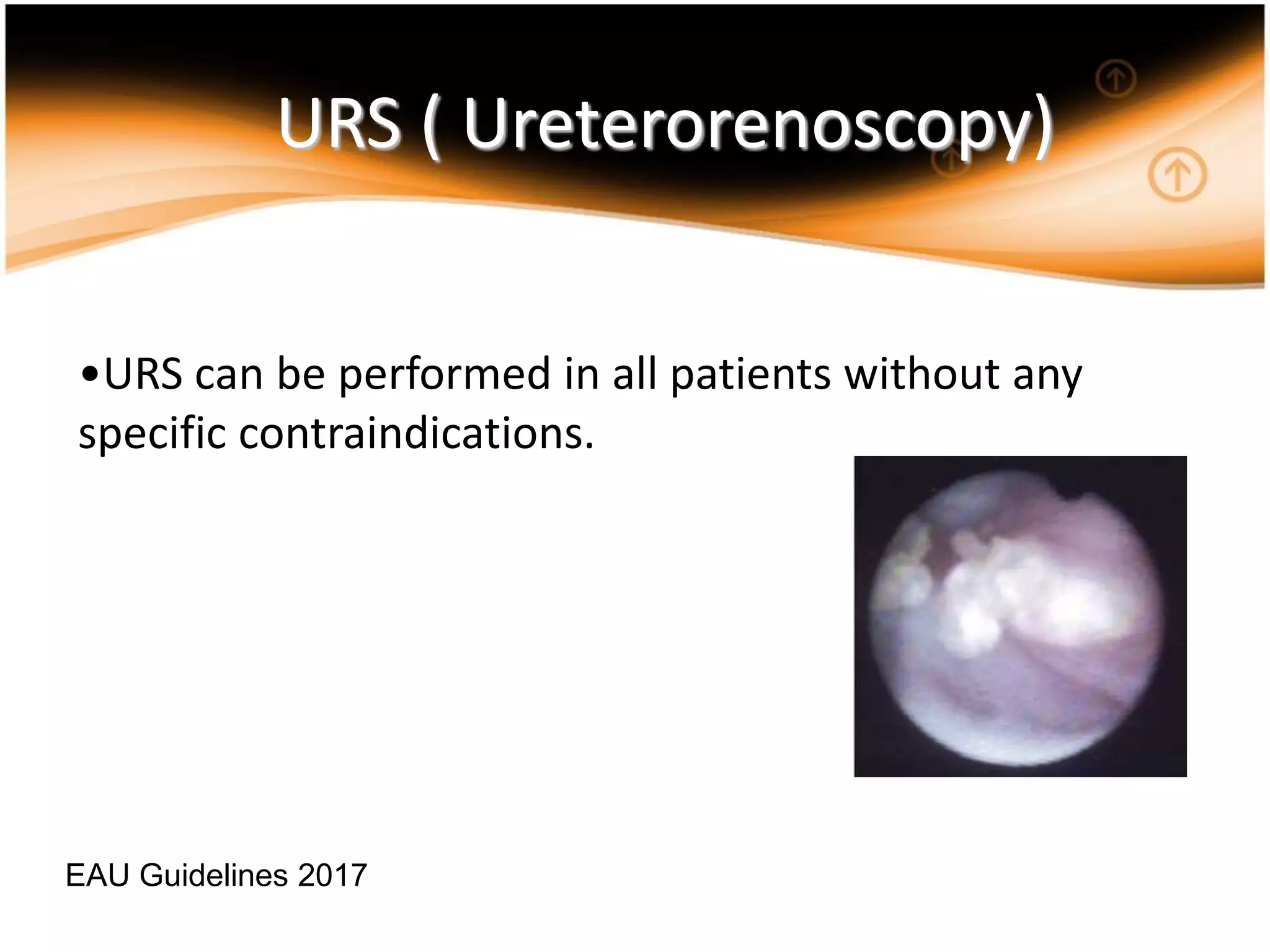 Urinary Stone Management and Infection.pptx