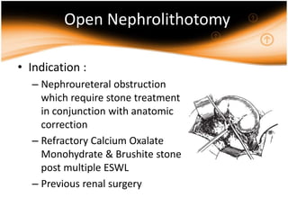 Urinary Stone Management and Infection.pptx