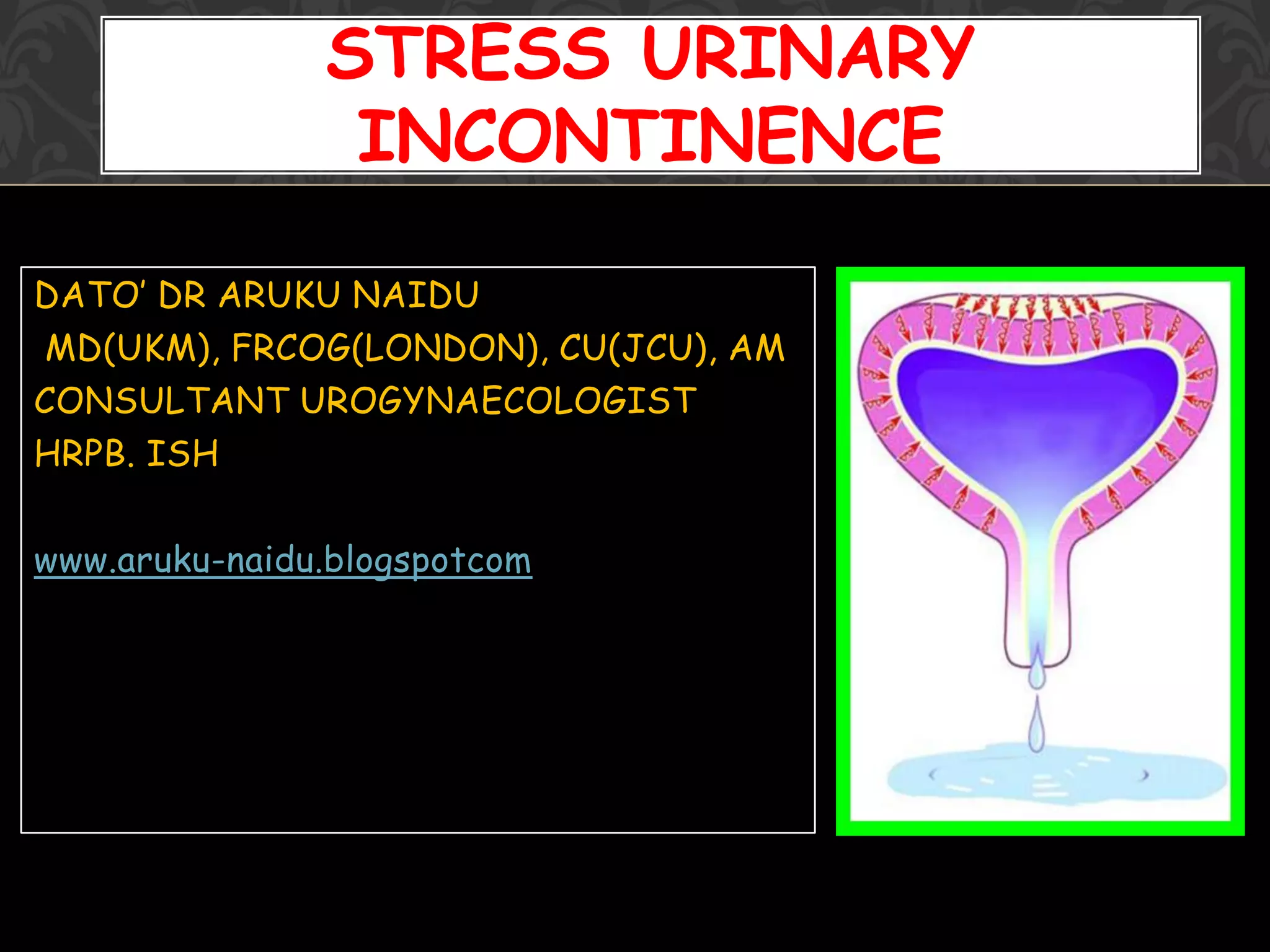 Urinary Stress Incontinence In Women | PDF